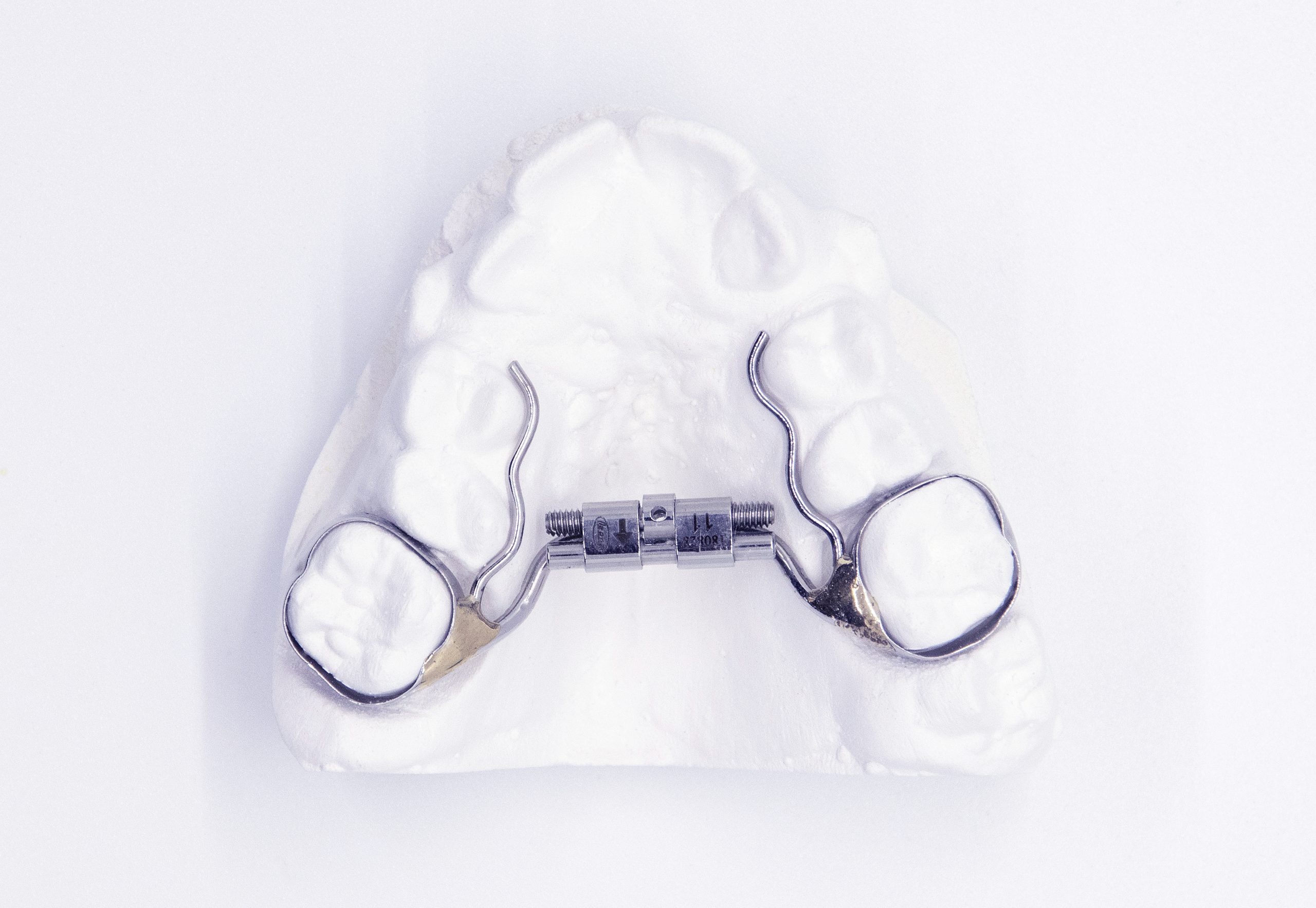 Fixed Appliances – Perfect Finish Ortho Lab Inc.