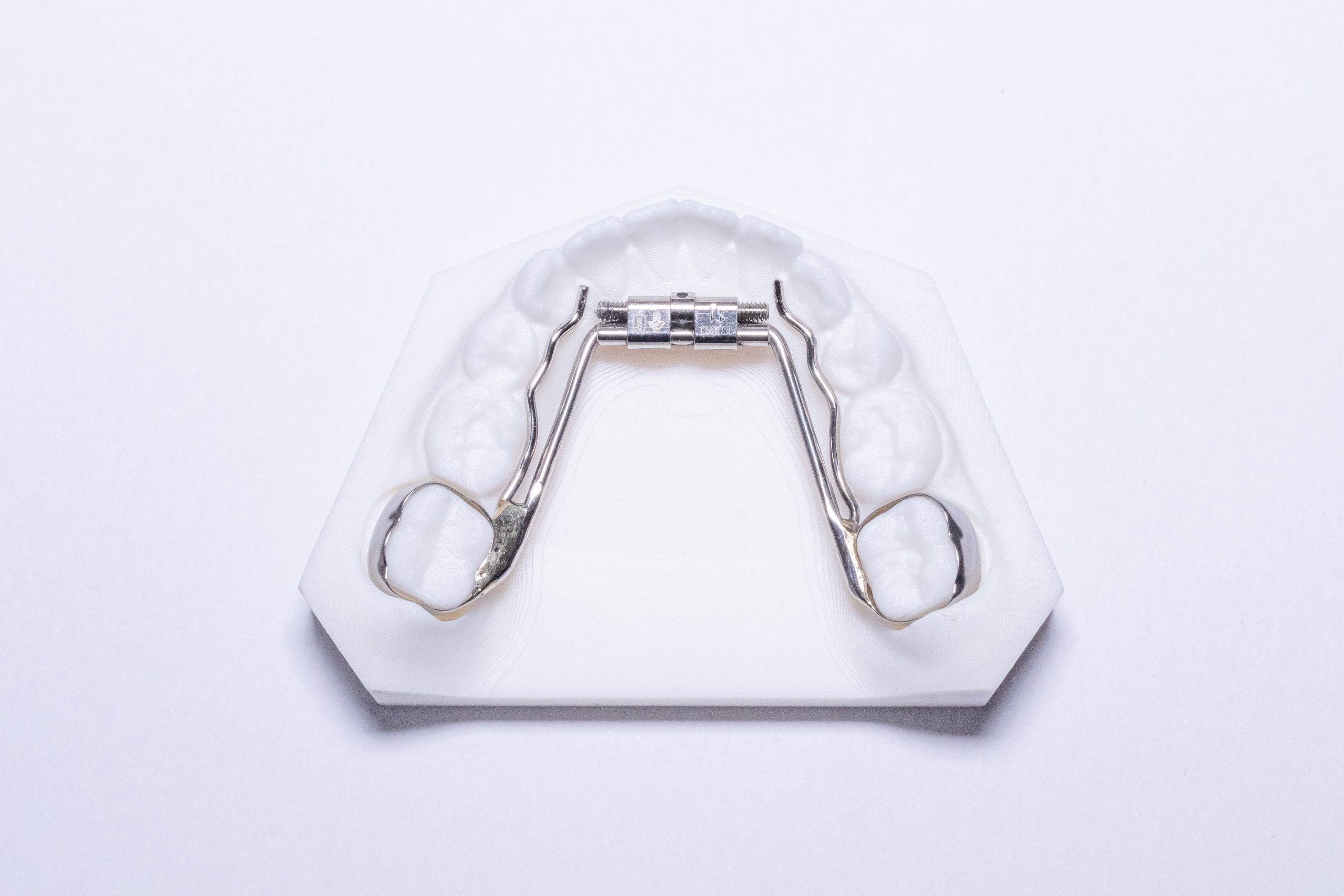 Fixed Appliances – Perfect Finish Ortho Lab Inc.