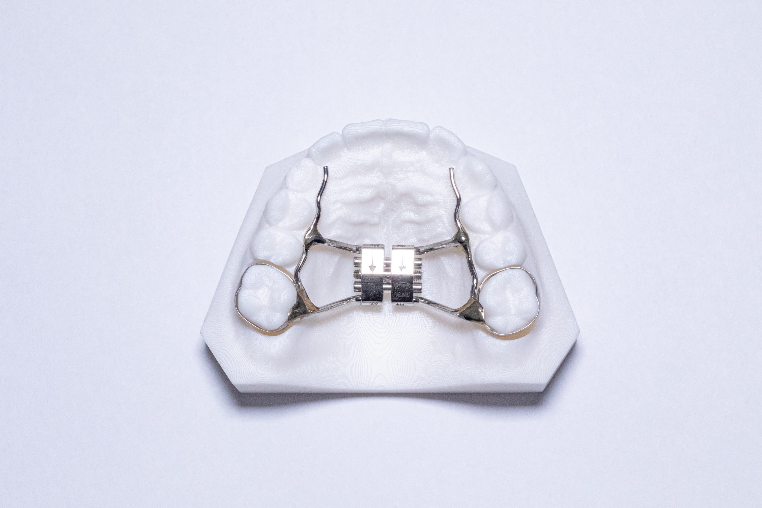 Fixed Appliances – Perfect Finish Ortho Lab Inc.