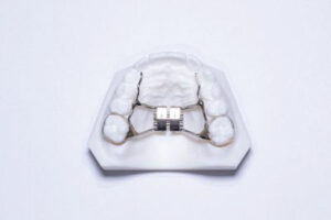Fixed Appliances - Perfect Finish Ortho Lab